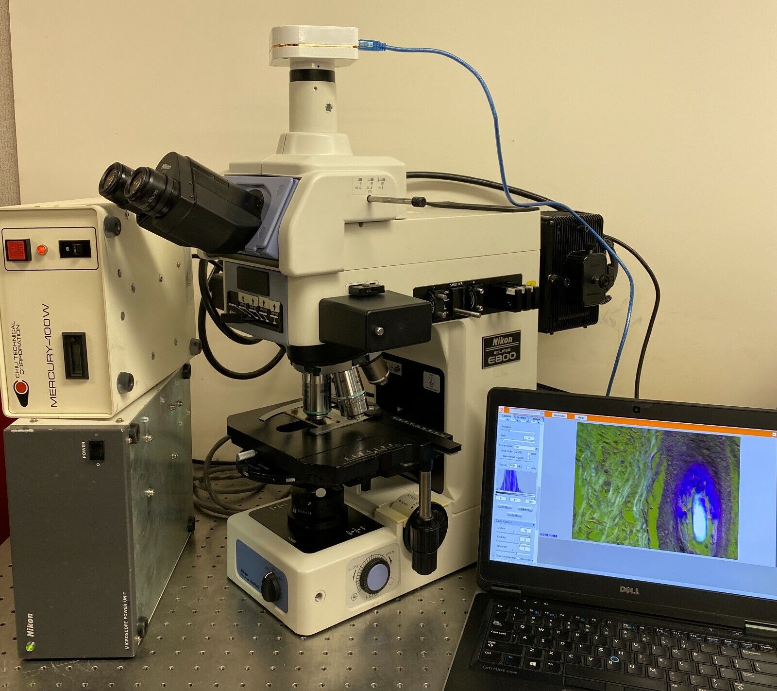 Nikon Eclipse E800 Nomarski DIC Fluorescent Microscope Ergo Nikon Eclipse E800 Nomarski DIC Fluorescent Microscope Ergo
