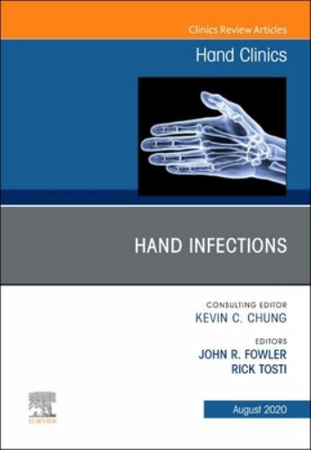 The Clinics: Orthopedics Ser.: Hand Infections, an Issue of Hand ...