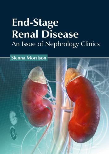 End-Stage Renal Disease: an Issue of Nephrology Clinics by Sienna ...
