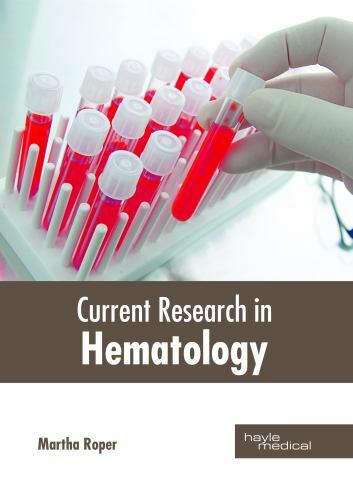 Current Research in Hematology by Martha Roper (2018, Hardcover) for ...