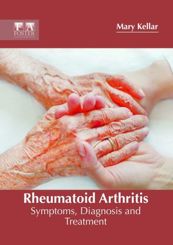 Rheumatoid Arthritis: Symptoms, Diagnosis and Treatment by Mary Kellar ...
