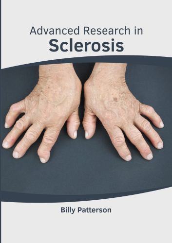 Advanced Research in Sclerosis by Billy Patterson (2022, Hardcover) for ...