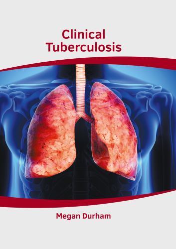Clinical Tuberculosis by Megan Durham (2022, Hardcover) for sale online ...
