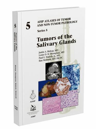 Afip Atlas of Tumor and Non-Tumor Pathology, Series 5 Ser.: Tumors of the Salivary Glands : 5f05 ...