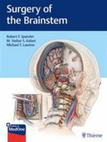 Surgery of the Brainstem by M. Yashar Kalani (2019, Hardcover / eBook ...