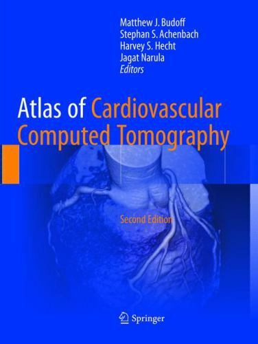 Atlas of Cardiovascular Computed Tomography by Stephan S. Achenbach ...