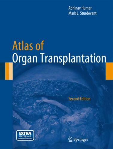 Atlas of Organ Transplantation by Mark L. Sturdevant (2015, Hardcover ...