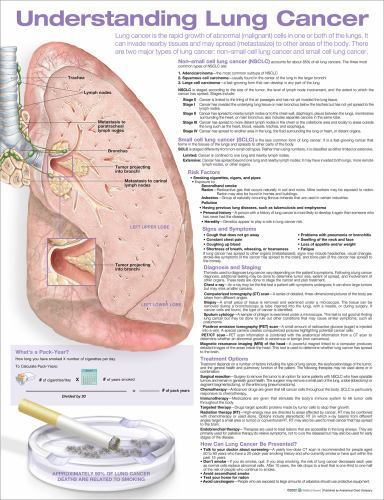 Understanding Lung Cancer Anatomical Chart by Anatomical Chart Company ...