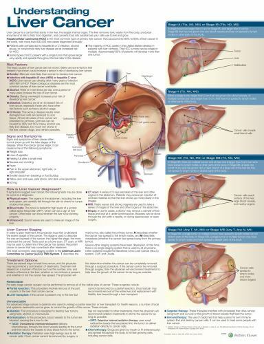 Understanding Liver Cancer Anatomical Chart by Anatomical Chart Company ...