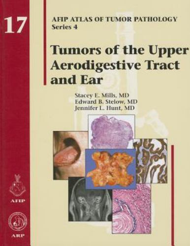 Afip Atlas of Tumor Pathology, Series 4, Ser.: Tumors of the Upper Aerodigestive Tract and Ear ...
