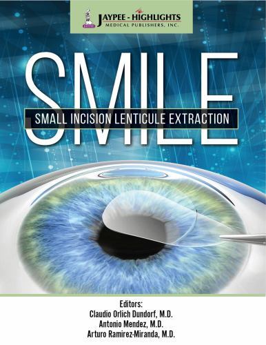 Smile : Small Incision Lenticule Extraction by Antonio Mendez, Arturo ...