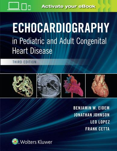 Echocardiography in Pediatric and Adult Congenital Heart Disease by ...