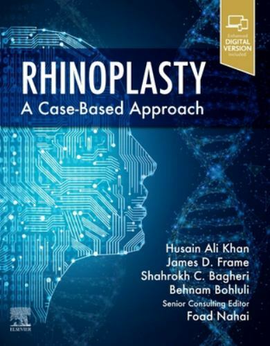 Rhinoplasty : A Case-Based Approach by Husain Ali Khan, James D. Frame ...