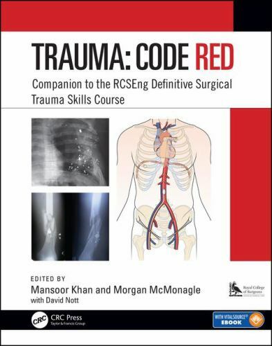Trauma: Code Red : Companion to the RCSEng Definitive Surgical Trauma ...