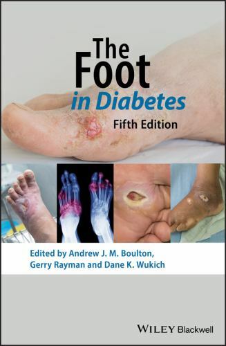 Practical Diabetes Ser.: Foot in Diabetes by Gerry Rayman (2020 ...