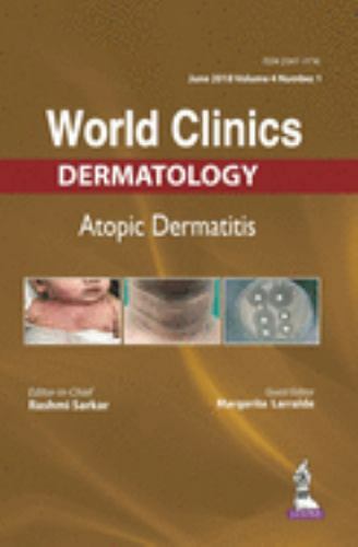 World Clinics: Dermatology, June 2018 : Atopic Dermatitis by Rashmi ...