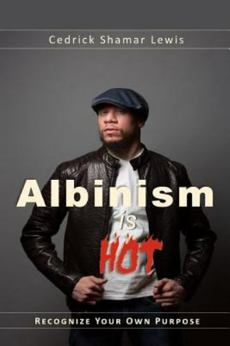 Albinism Is Hot! by Cedrick Shamar Lewis (2017, Trade Paperback) for ...
