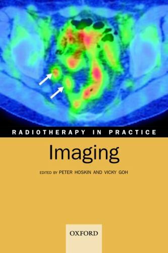 Radiotherapy in Practice Ser.: Radiotherapy in Practice - Imaging by ...