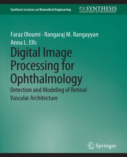 Digital Image Processing for Ophthalmology : Detection and Modeling of ...
