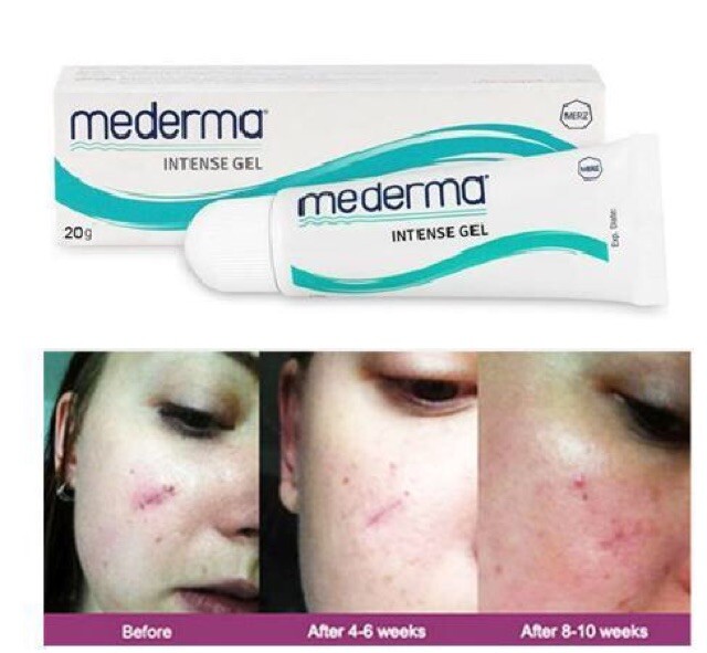 Купить Средство от растяжек Mederma Proactive INTENSIVE GEL scars/acne ...