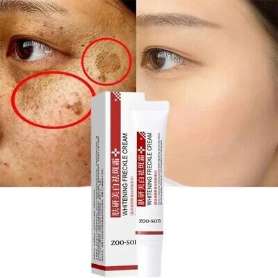 whitening freckle cream remove melasma remove dark spots melanin brightening 393523005202