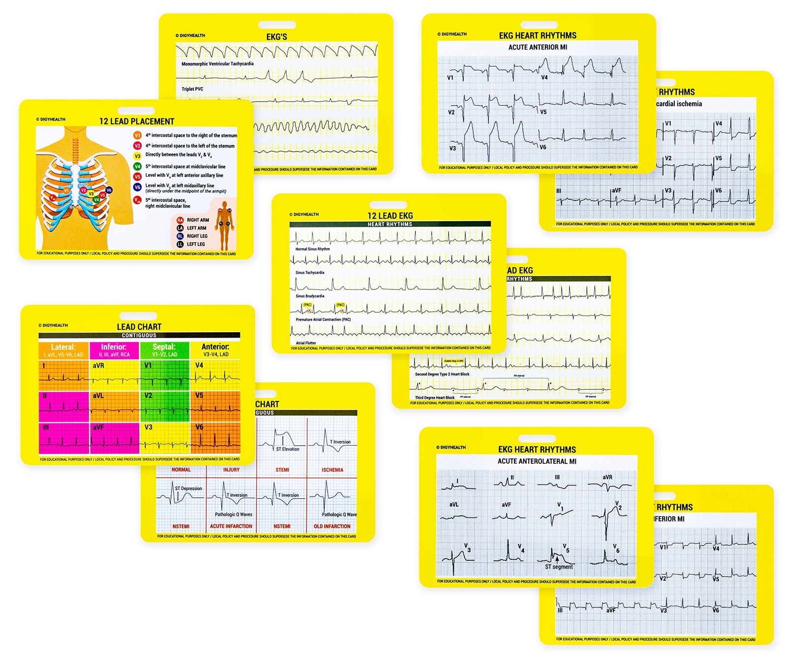 EKG 5 Card Set Common Cardiac Rythms Lead Placement Telemetry Cards for ...