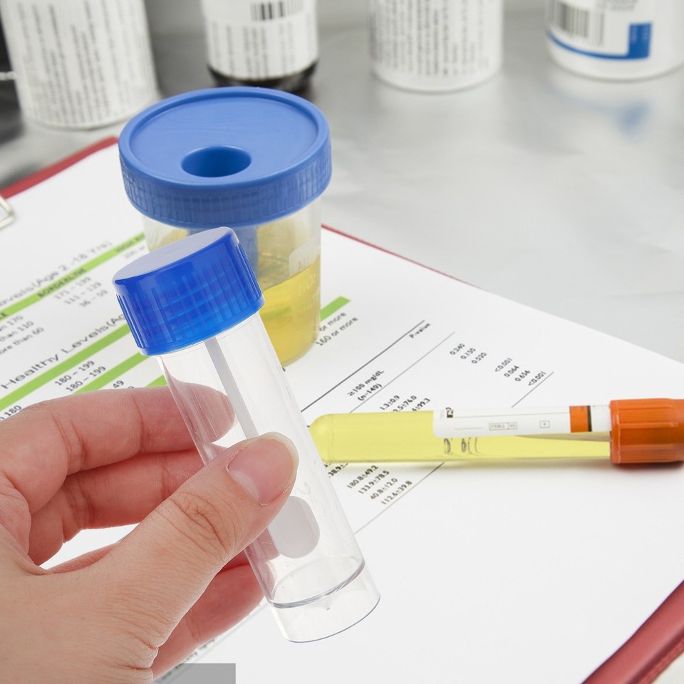 5 PCS Stool Sample Pots with Spoon Plastic Specimen Cup Container | eBay UK