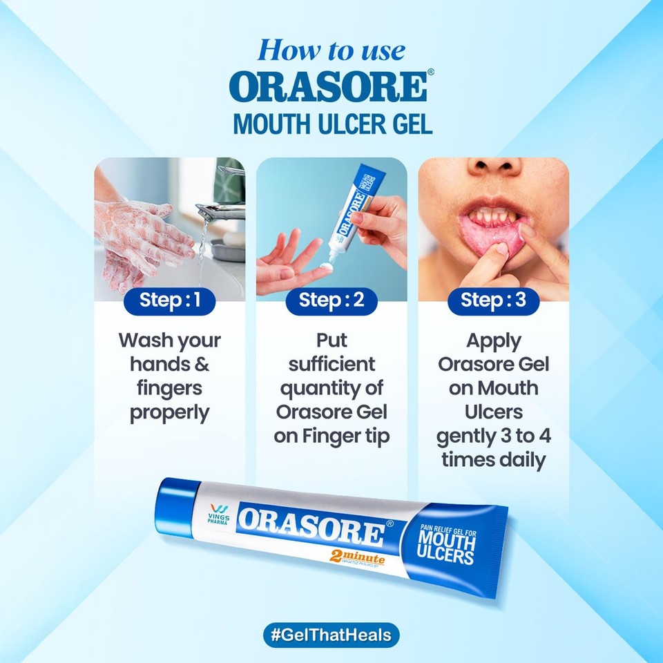 4 X Orasore Mouth Cream Gel For Mouth Ulcer and Sore Throat irritation ...