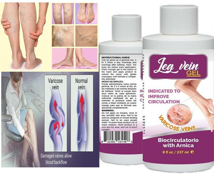 Support varicose spider supplement & gel cream varices veins duo ...