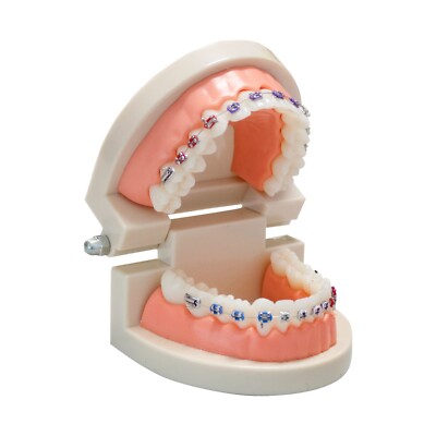 Dental Teach Typodont Demonstration Teeth Model with Braces For Patient ...