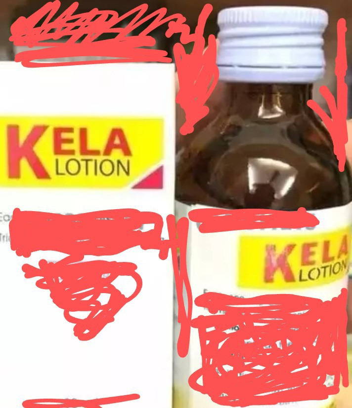 KELA LOTION Anti Itch Relief Dry Skin Inflamation 60ml Psoriasis New ...