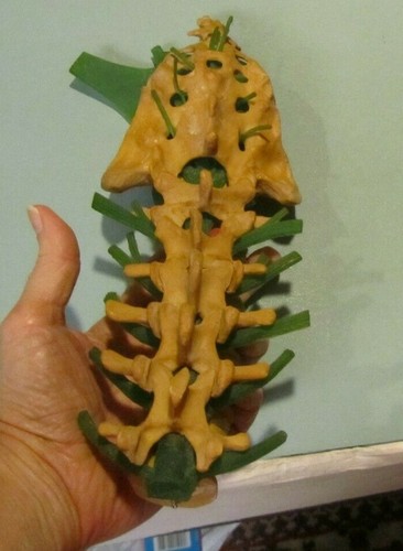 Vintage Medical Anatomy Model Lumbar Sacrum Spine Composite ...