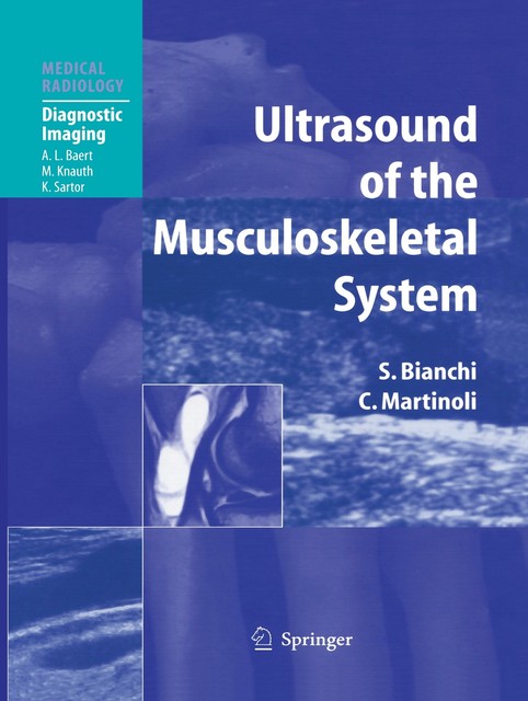 Ultrasound of The Musculoskeletal System von Carlo Martinoli (2016 ...