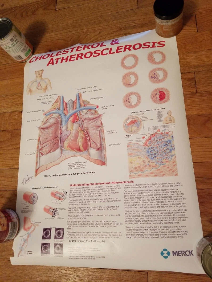 Cholesterol Posters