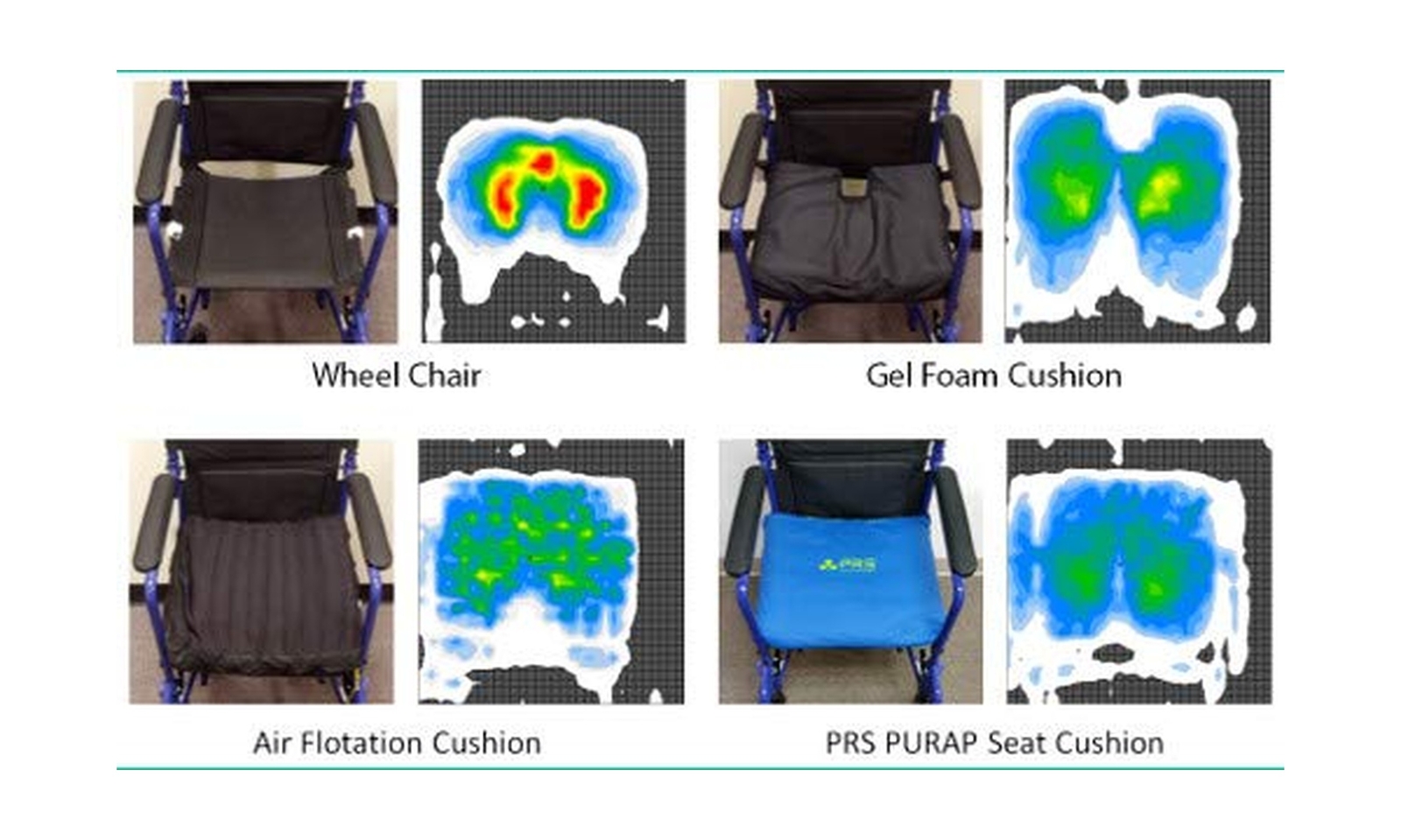 PURAP Wheelchair, Lift Chair & Scooter Cushion - Prevent & Heal ...