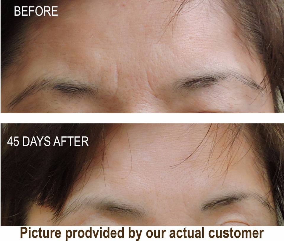 Argireline Overnight Firming Serum ,Snap 8,Syn-Ake,Syn-Coll ...