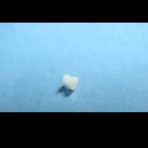 Teflon Grommet Ear Ventilation Tubes WITHOUT WIRE, Shepard Type 10 ...