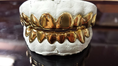 10X Custom Grill Mold Putty Molding kit Impression Kit for Silver Gold ...