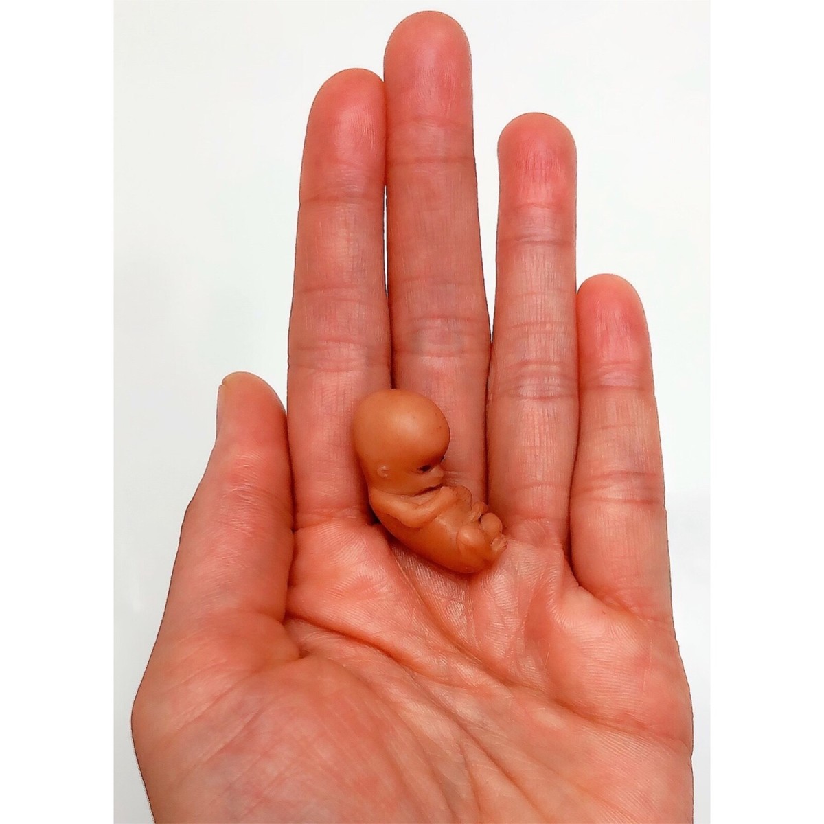At 1 Week Old Fetus