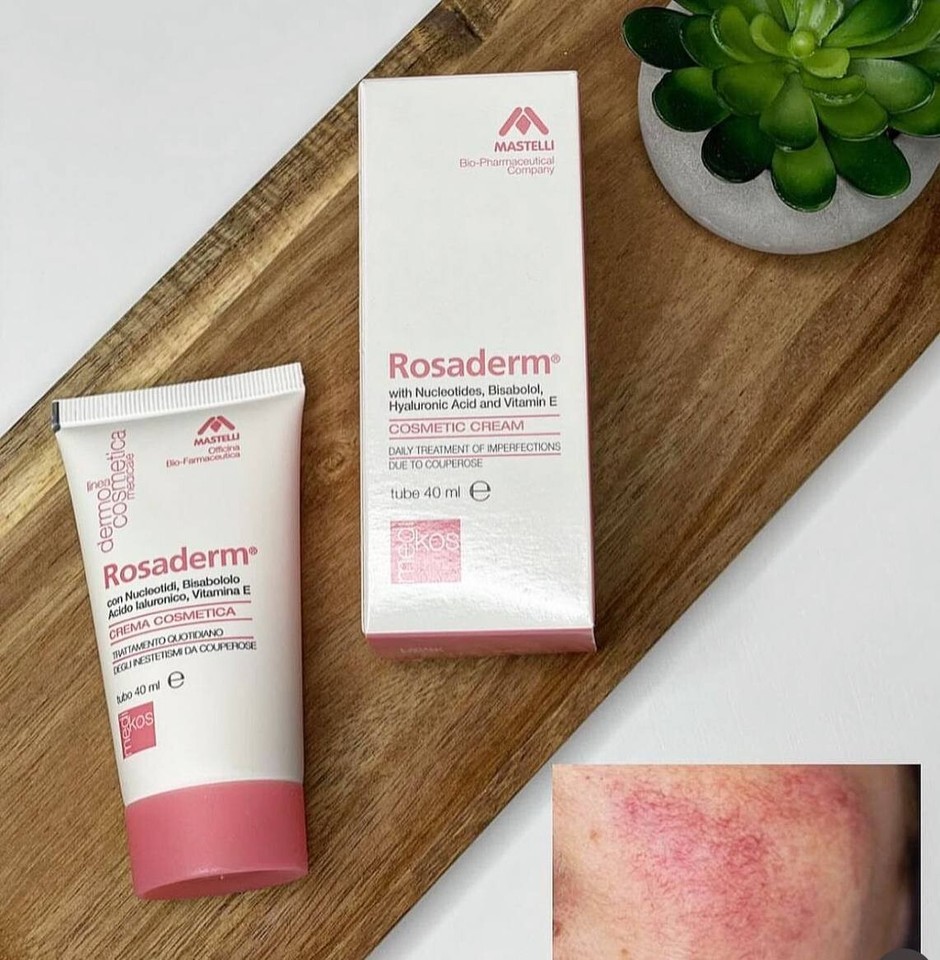 Restorative cream to reduce the appearance of couperosis and rosacea ...