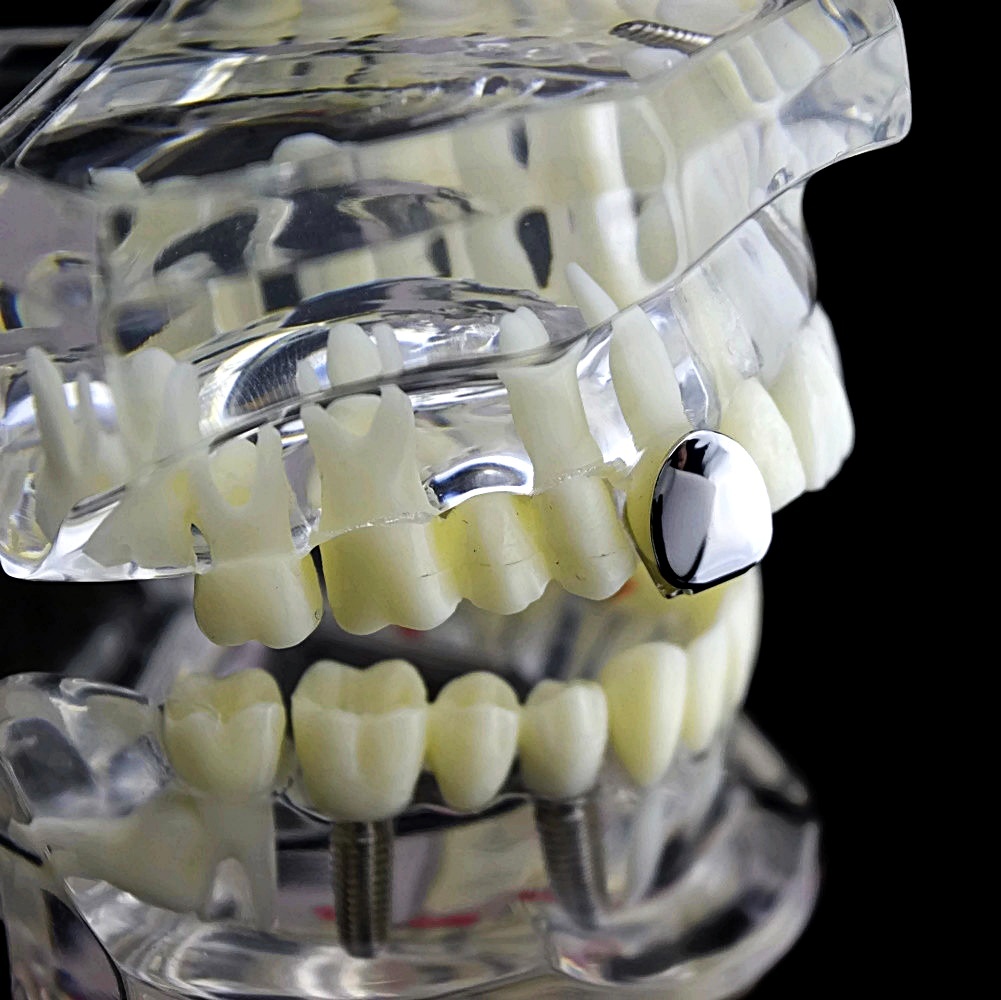 Platinum Teeth Caps