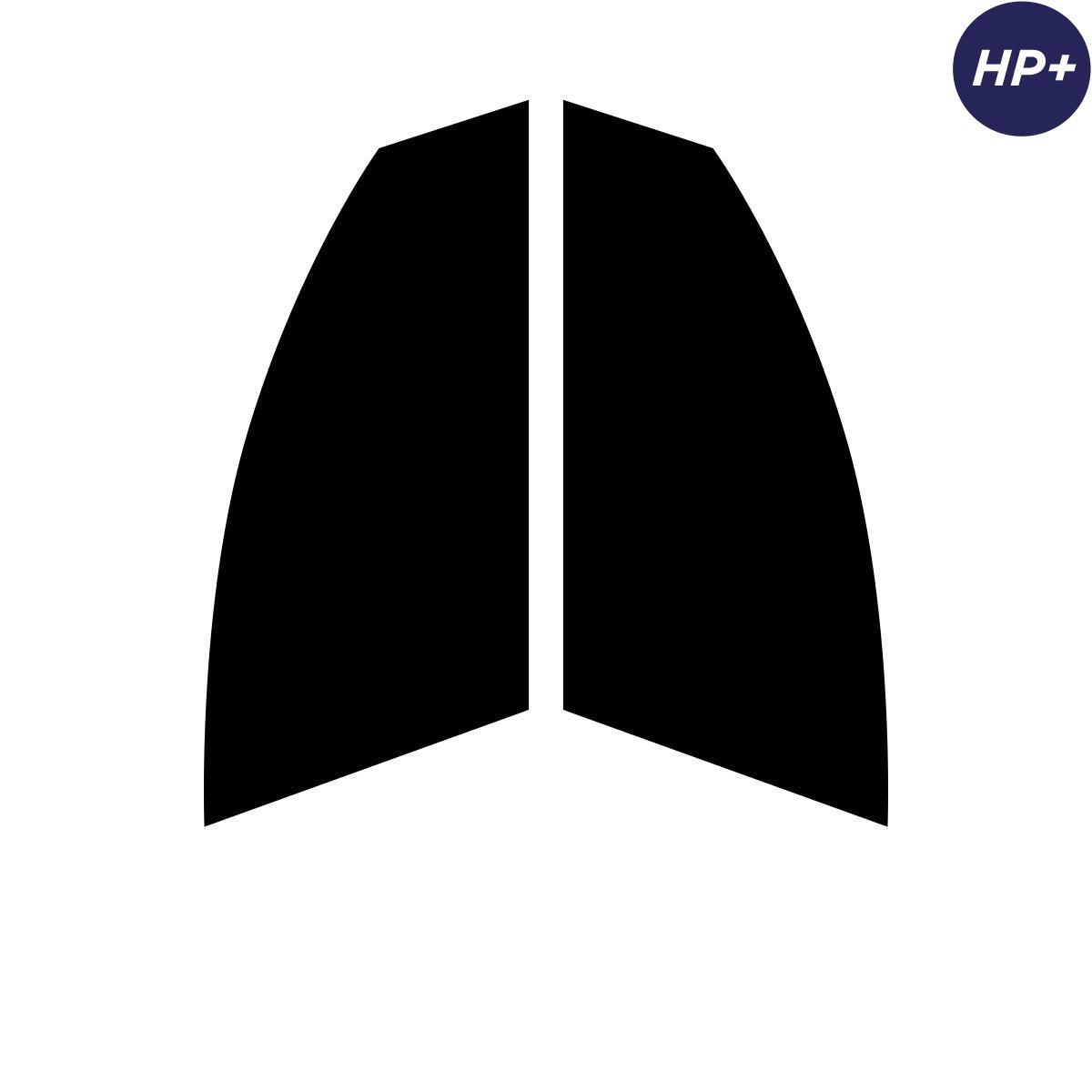 For Renault Kangoo Van (Hatch boot) 2007+ Carbon Pre Cut Window Tint ...