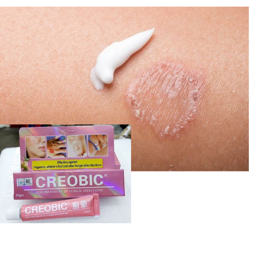 Creobic Scabies Treatment Cream Cure Skin Parasites Itching Anti Fungus ...