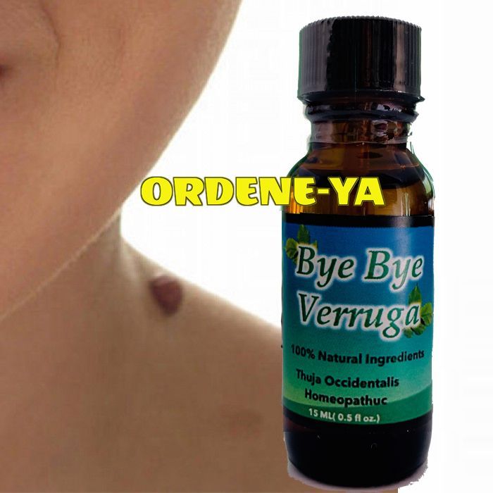 Bye Bye Verruga Sani Skin Skim Away Of Wart Remover Tag SaniSkin Out ...