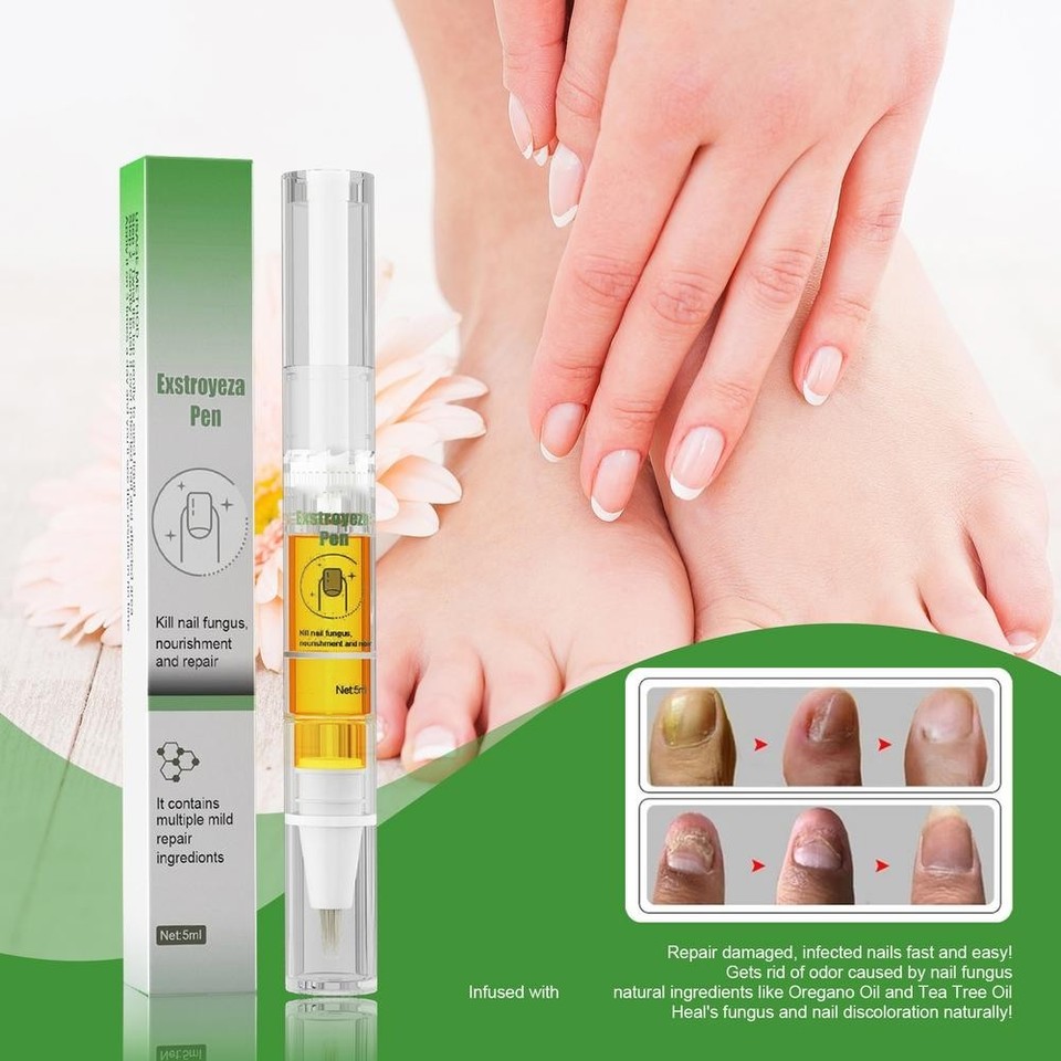 Nail Fungus Repair Pen Remove Onychomycosis Paronychia Infection Toe ...