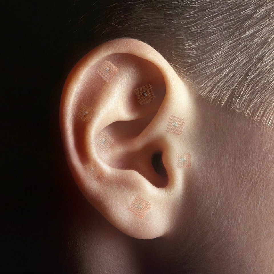 300pcs Magnetic Therapy Ear Patch Auricular Auriculotherapy Acupuncture ...