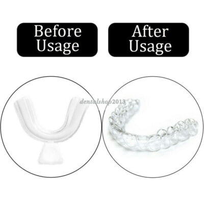10pcs Whitening Teeth Moldable Bleaching Whitening Trays Retainer ...