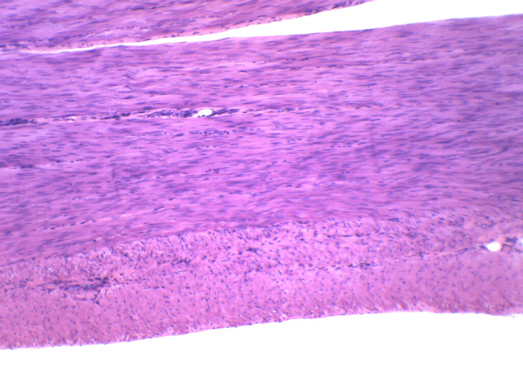 Smooth Muscle Slides