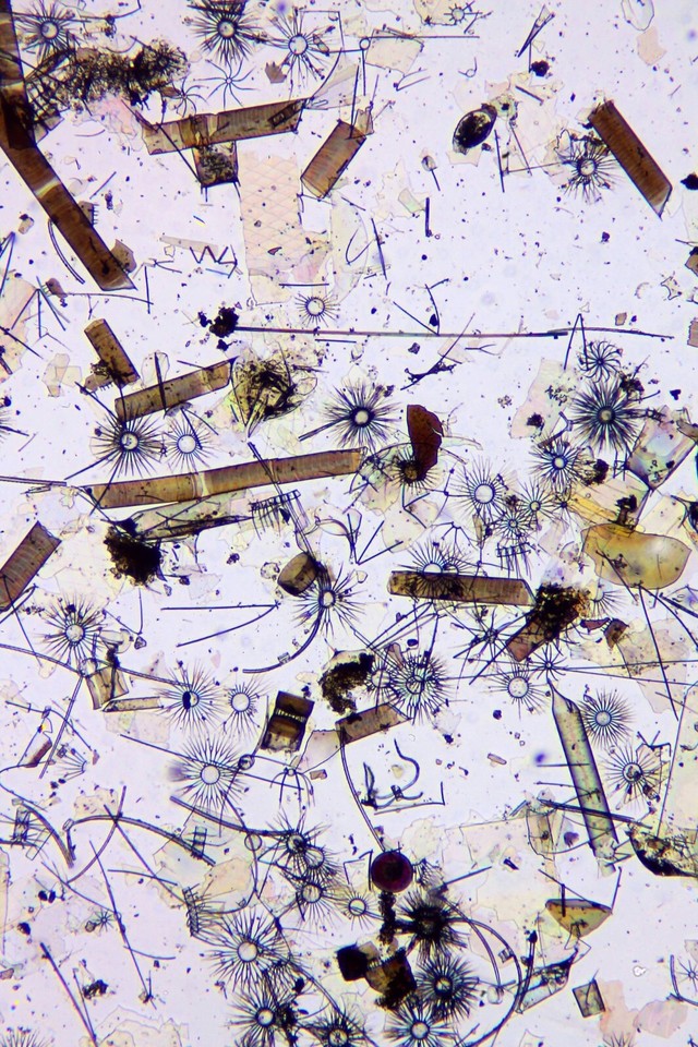 Antique microscope slide. Diatoms. Bacteriastrum, Rhizosolenia ...