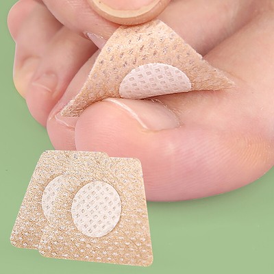 Nail Strip Foot Orthodontic Toe Thumb Nail Corrector Patch Correction ...